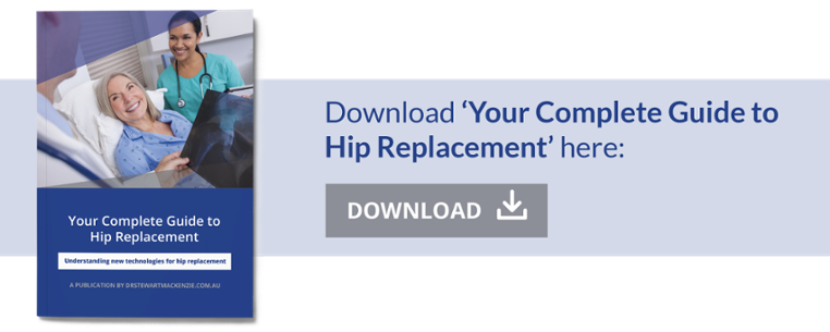 10 common questions answered about Hip Replacements » Dr Stuart MacKenzie